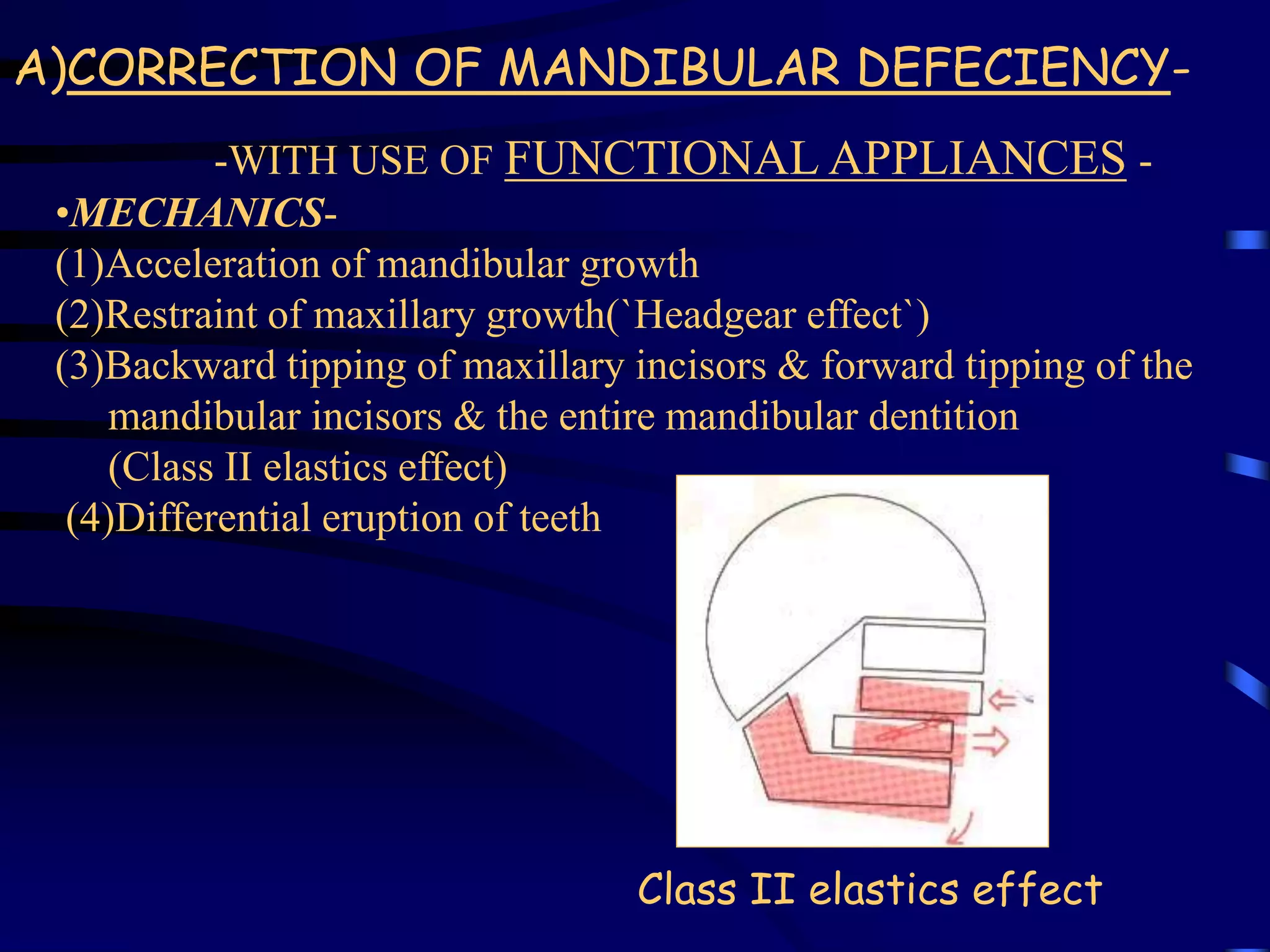 Treatment of class II | PPT