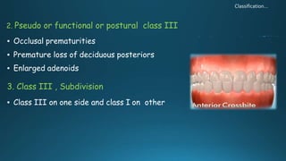 Treatment of class iii malocclusion | PPTX
