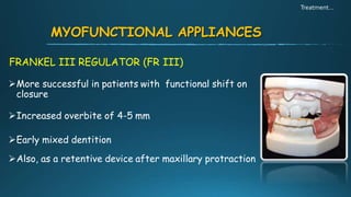Treatment of class iii malocclusion | PPTX