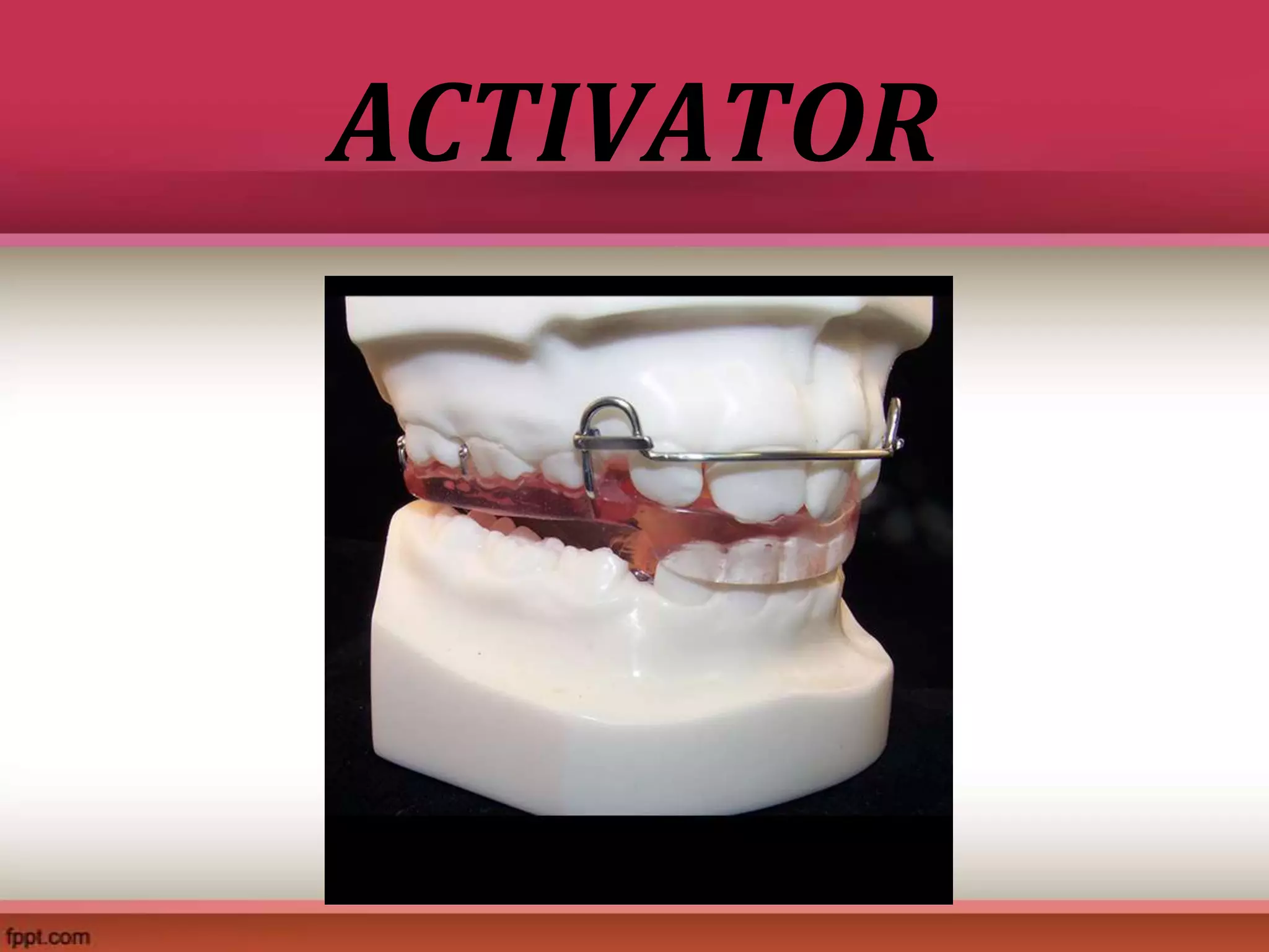 Treatment of class ii malocclusions | PPTX