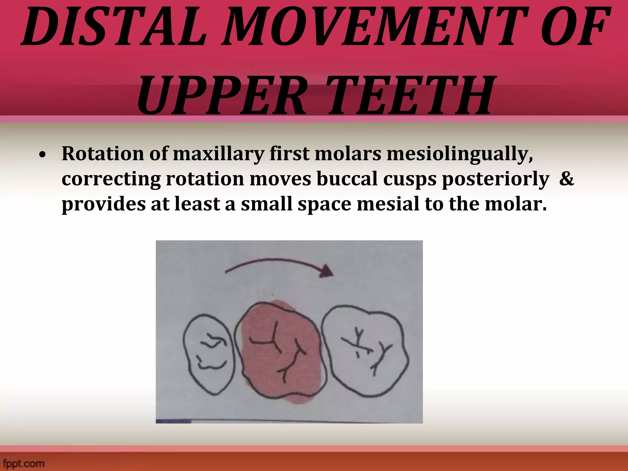 Treatment of class ii malocclusions | PPTX