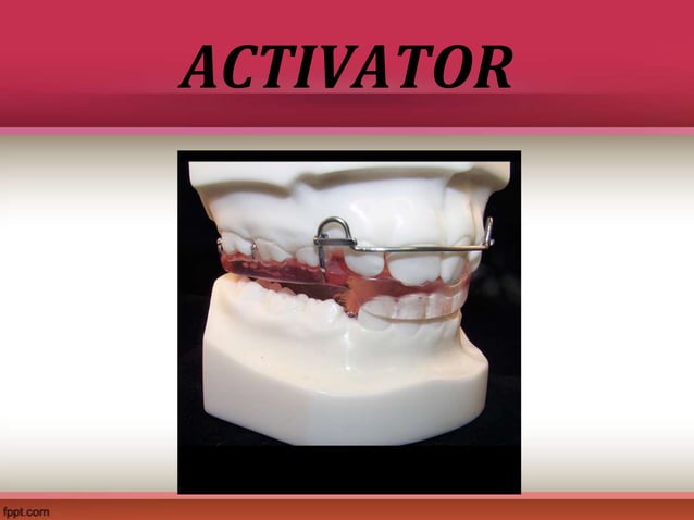 Treatment of class ii malocclusions | PPTX