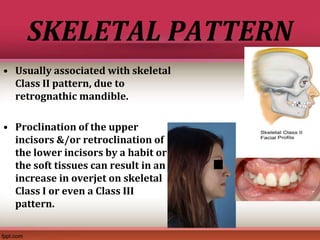 Treatment of class ii malocclusions | PPTX