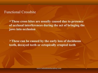 Treatment of crossbite /certified fixed orthodontic courses by Indian ...