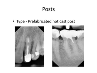 treatment of endodontics tooth.pptx