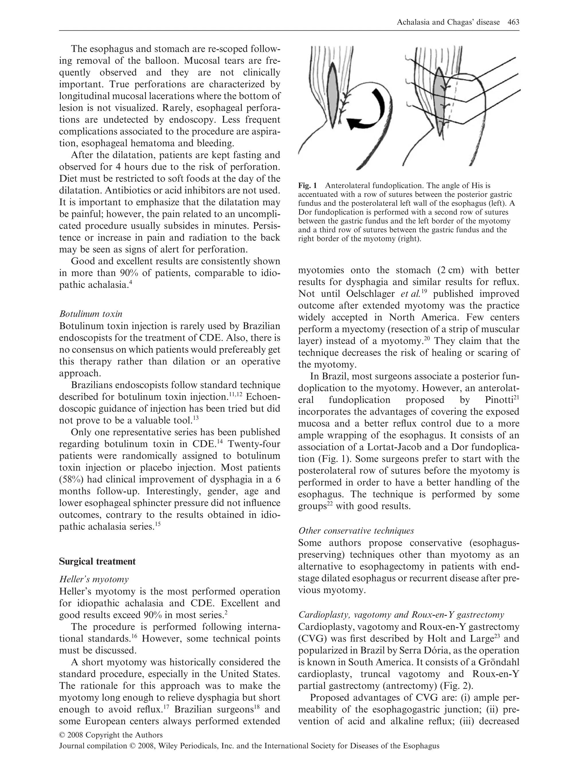 treatment_of_end stage achalasia of esophagus.pdf