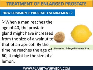 Treatment of enlarged prostate gland in Ayurveda | PPTX