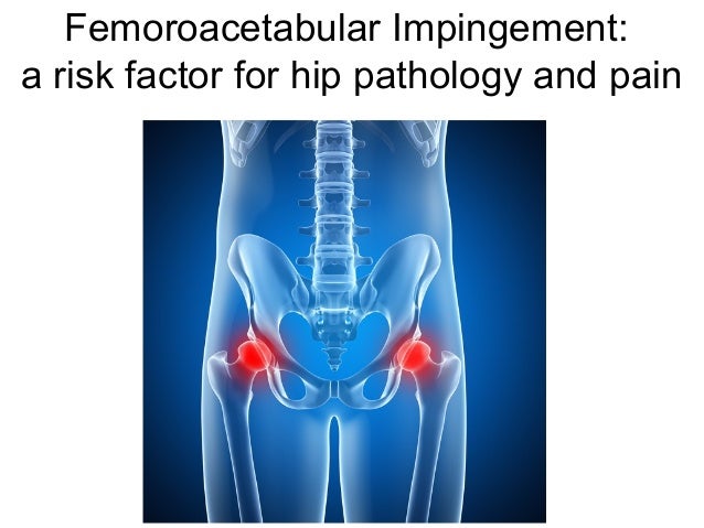 Arthroscopy of the Hip for Labral Pathology and FAI: Indications and