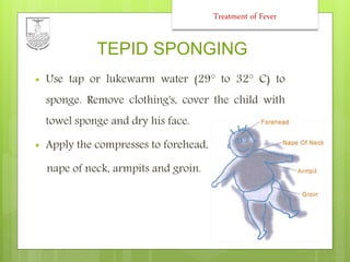 Tepid Sponging