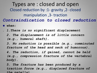 Treatment of fracture | PPTX