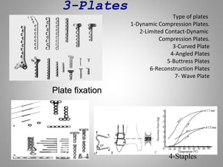 Treatment of fracture | PPTX