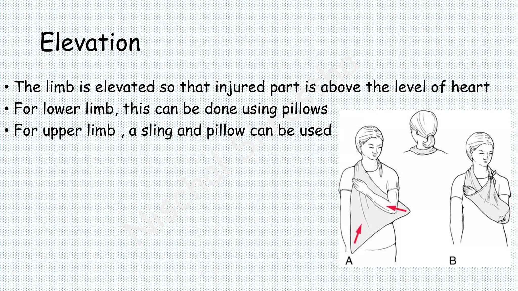 Management of Fractures | PPTX