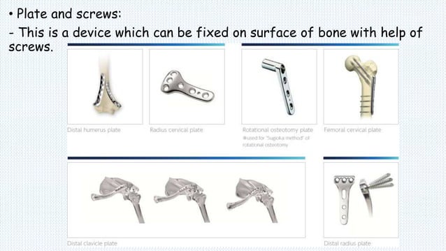 Management of Fractures | PPTX | First Aid | Injuries