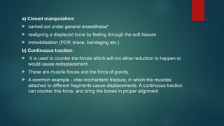 TREATMENT OF FRACTURES By Pooja Ramalingam | PPTX