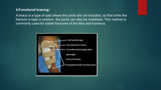 TREATMENT OF FRACTURES By Pooja Ramalingam | PPTX