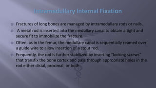 Treatment of fractures and dislocations | PPTX