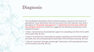 Treatment of furcation involved teeth / endodontics and periodontics | PPTX