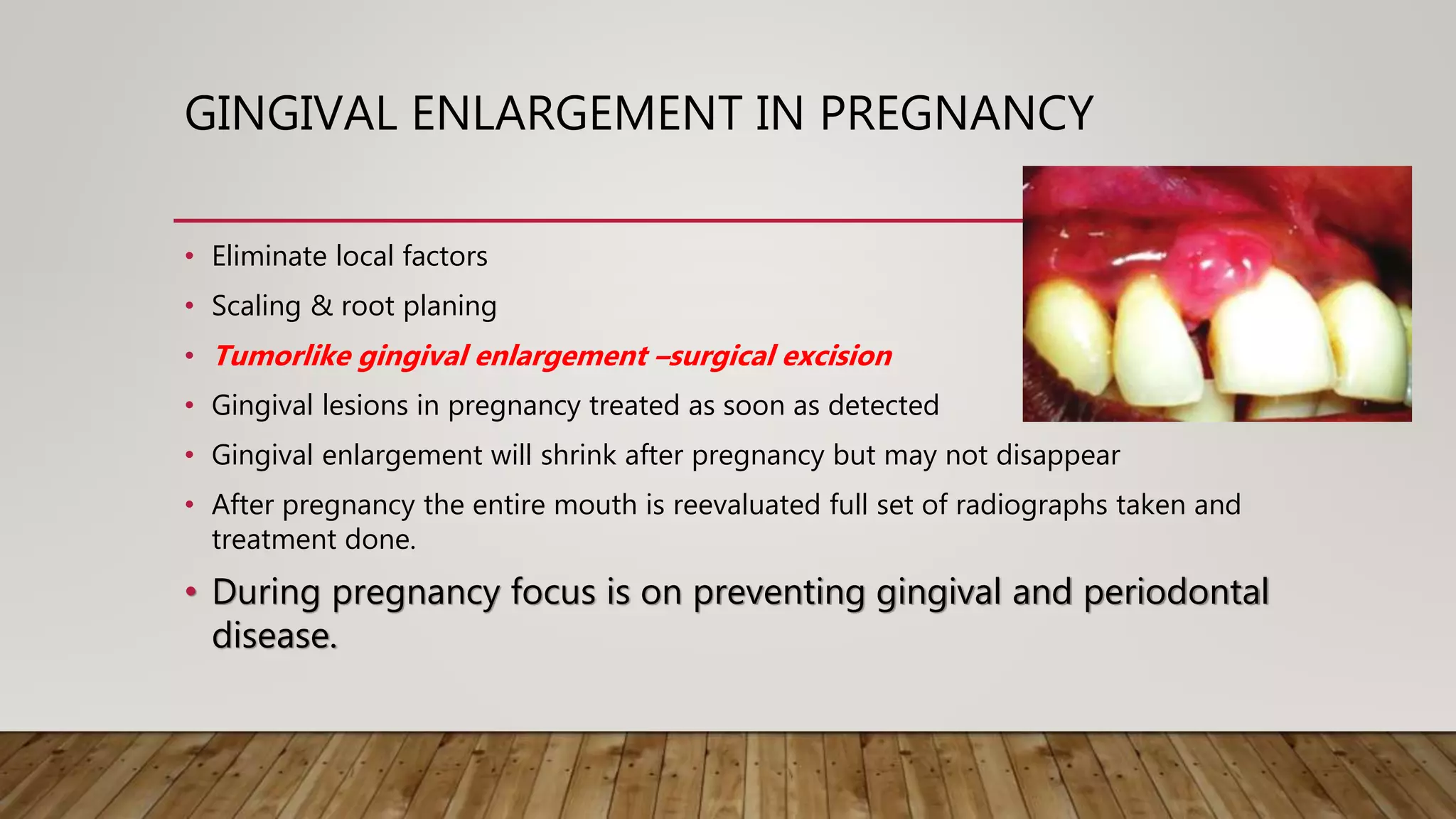 Treatment of gingival enlargement | PPTX