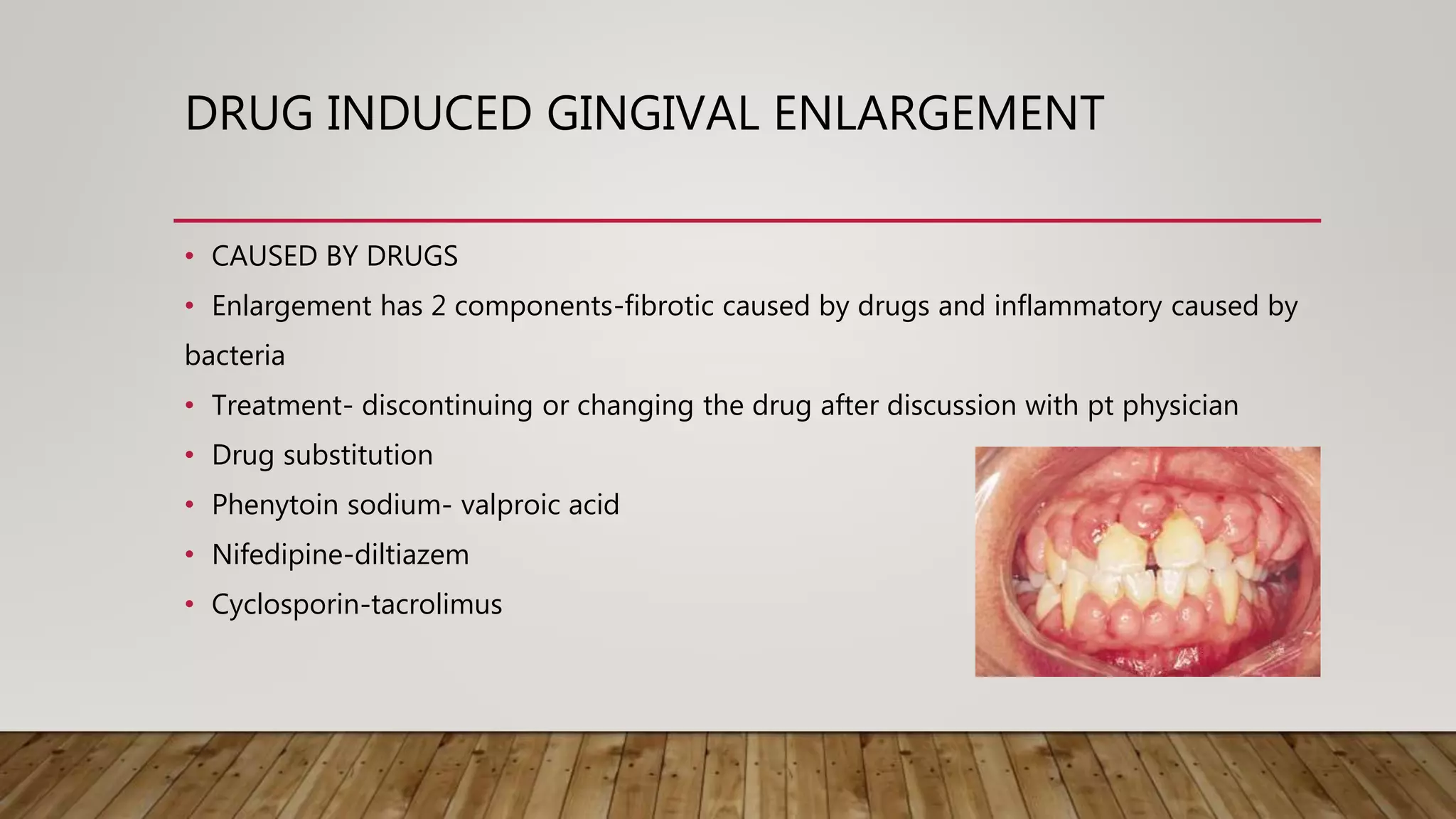 Treatment of gingival enlargement | PPTX