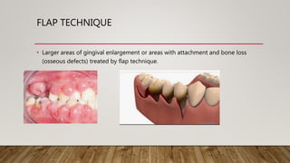 Treatment of gingival enlargement | PPTX