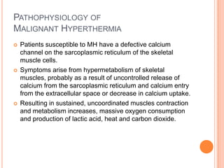 Treatment of malignant hyperthermia in an outpatient surgery center | PPTX