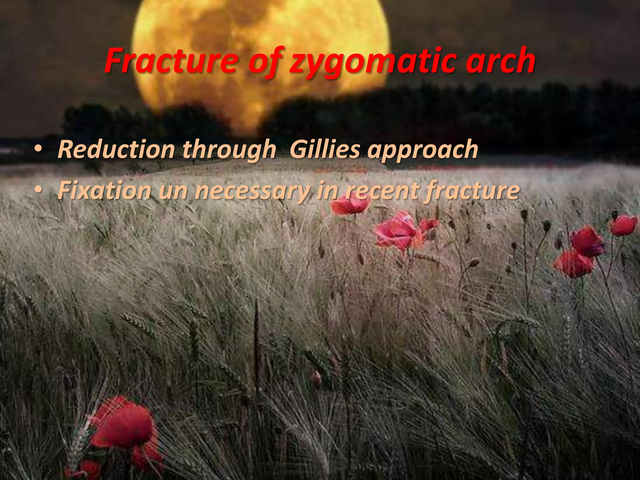 Treatment of midface fracture | PPSX