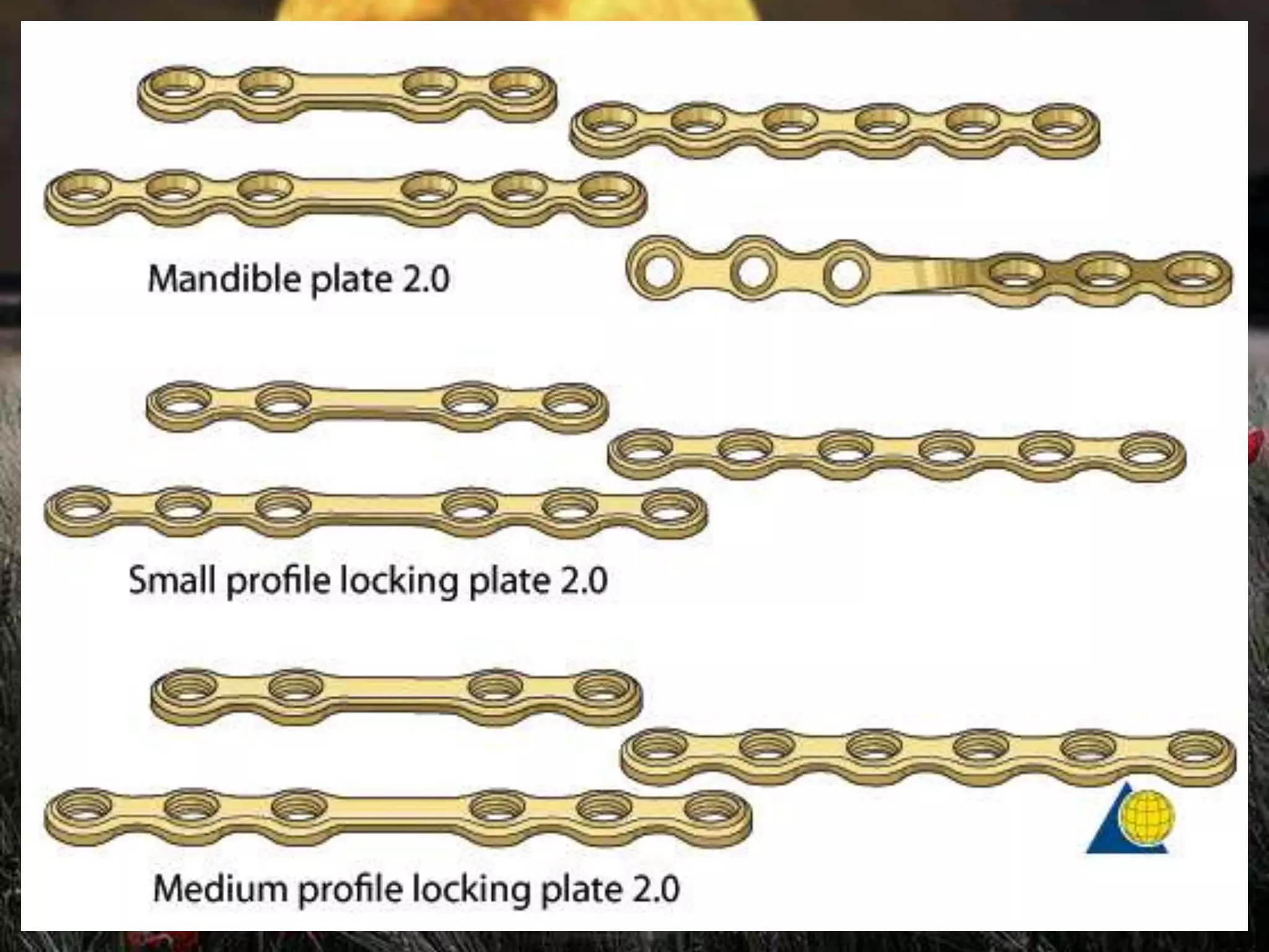 Treatment of midface fracture | PPSX