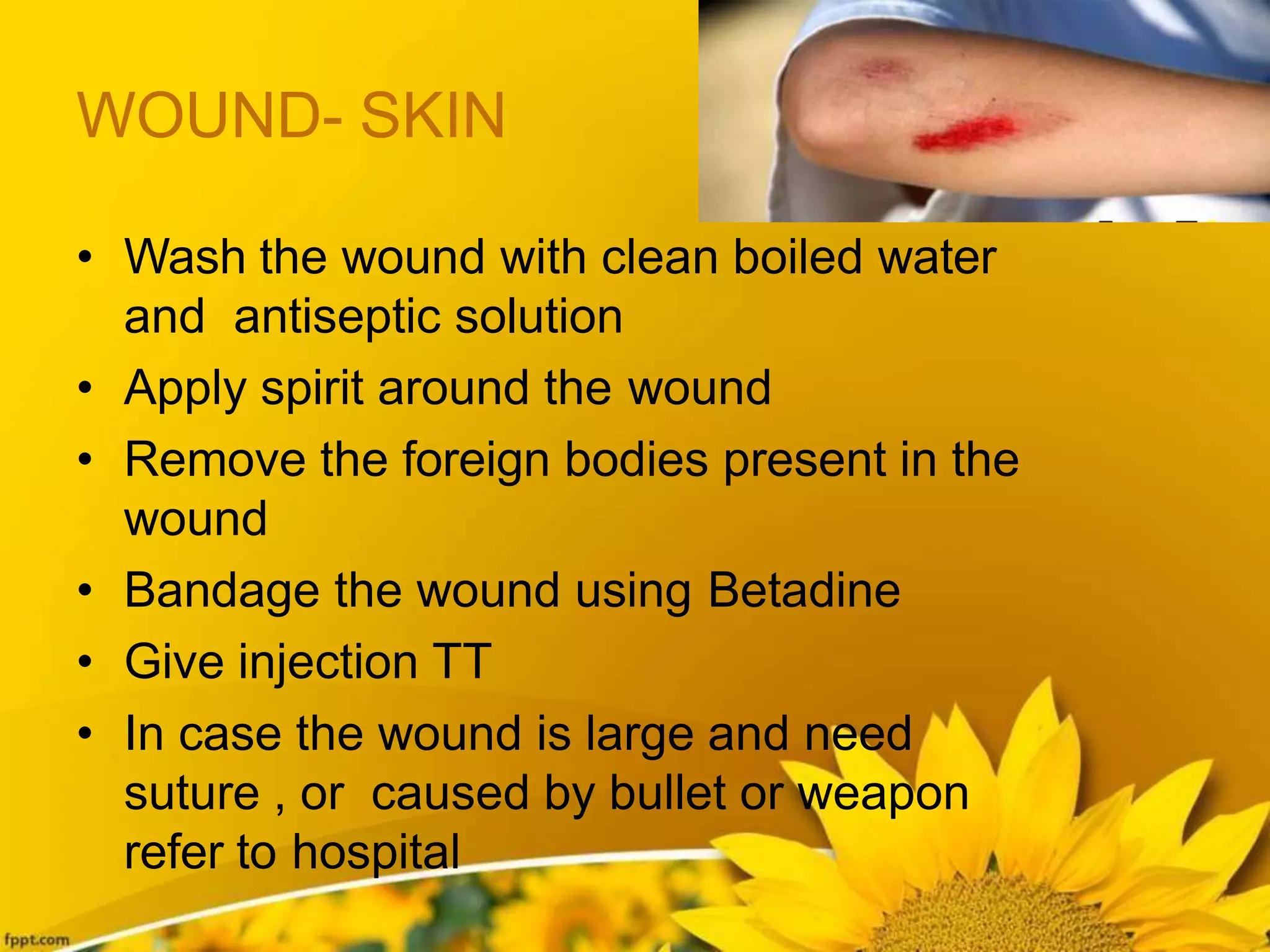 Treatment of minor ailments | PPTX