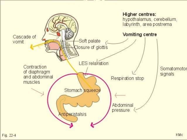 Pharmacology of Antiemetics & Prokinetics.pptx | Digestive Disorders ...