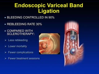 Treatment of portal hypertension | PPT