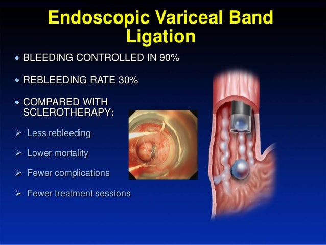 Treatment of portal hypertension