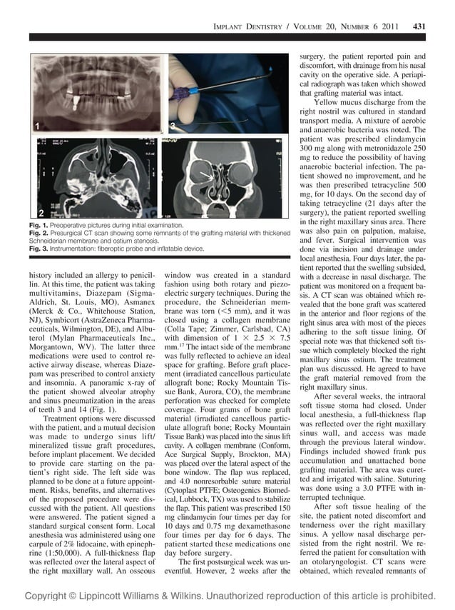 Treatment of severe sinus infection after sinus lift procedure a case ...