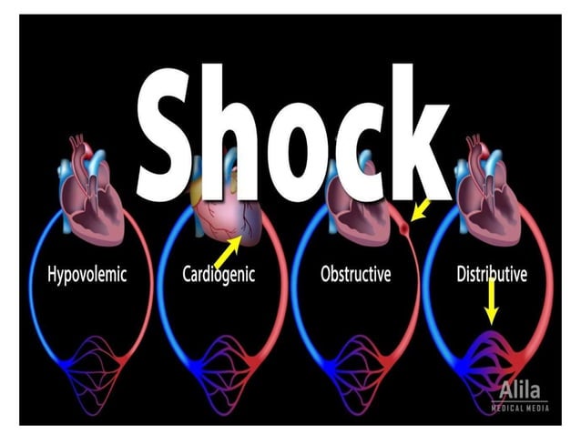 Treatment of shock | PDF