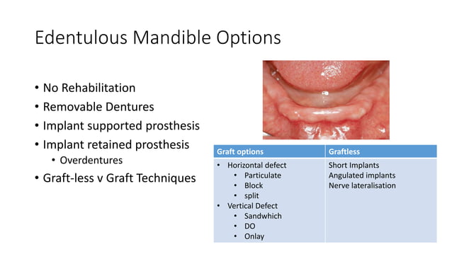 Treatment of the edentulous patient