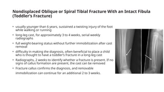Treatment of Tibia and Fibula Fractures.pptx