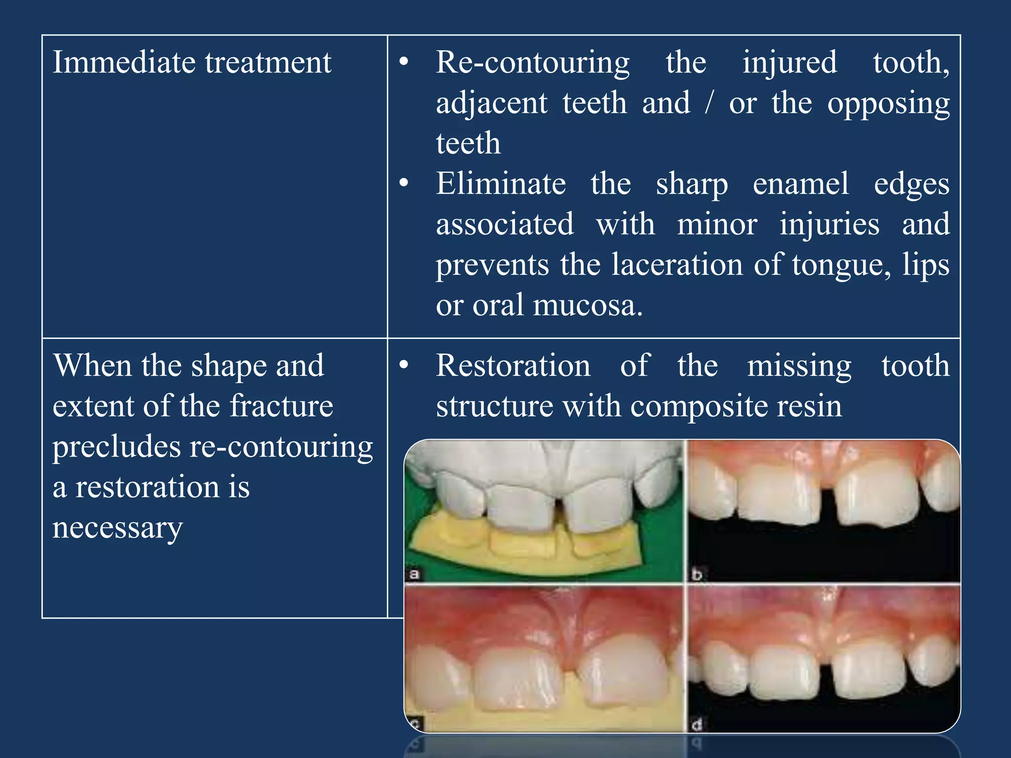 Treatment of traumatised tooth | PPTX