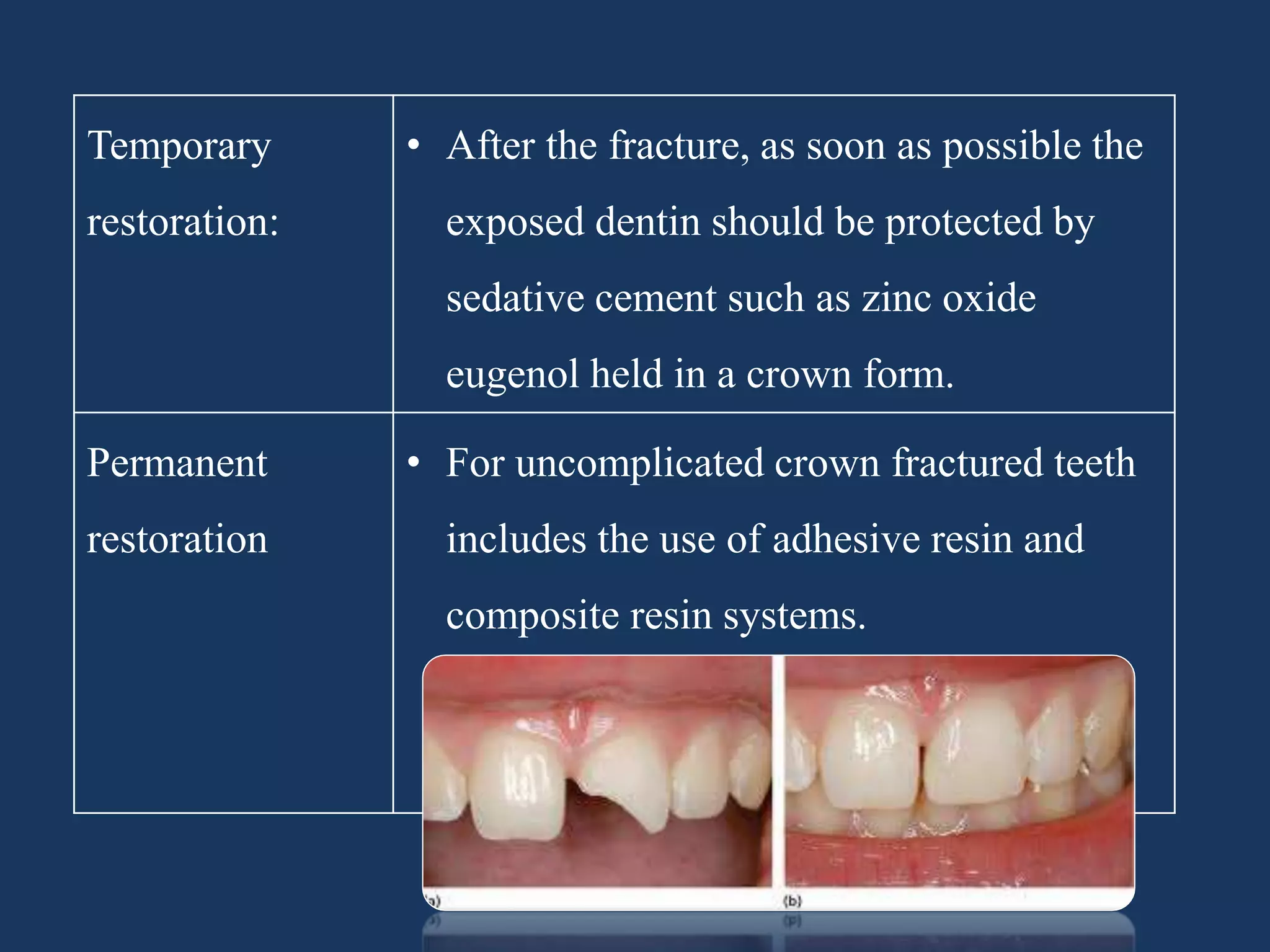 Treatment of traumatised tooth | PPTX
