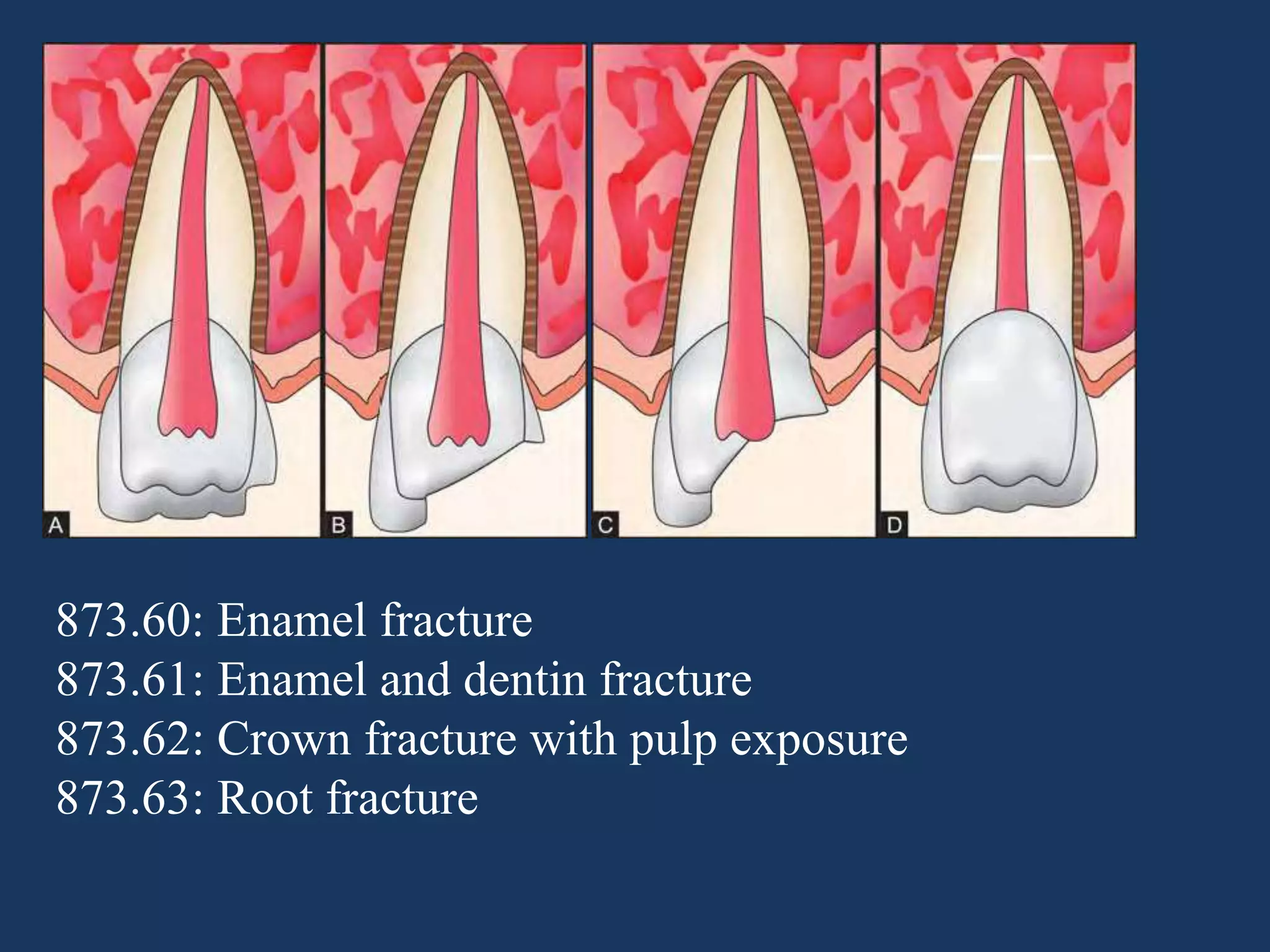 Treatment of traumatised tooth | PPTX