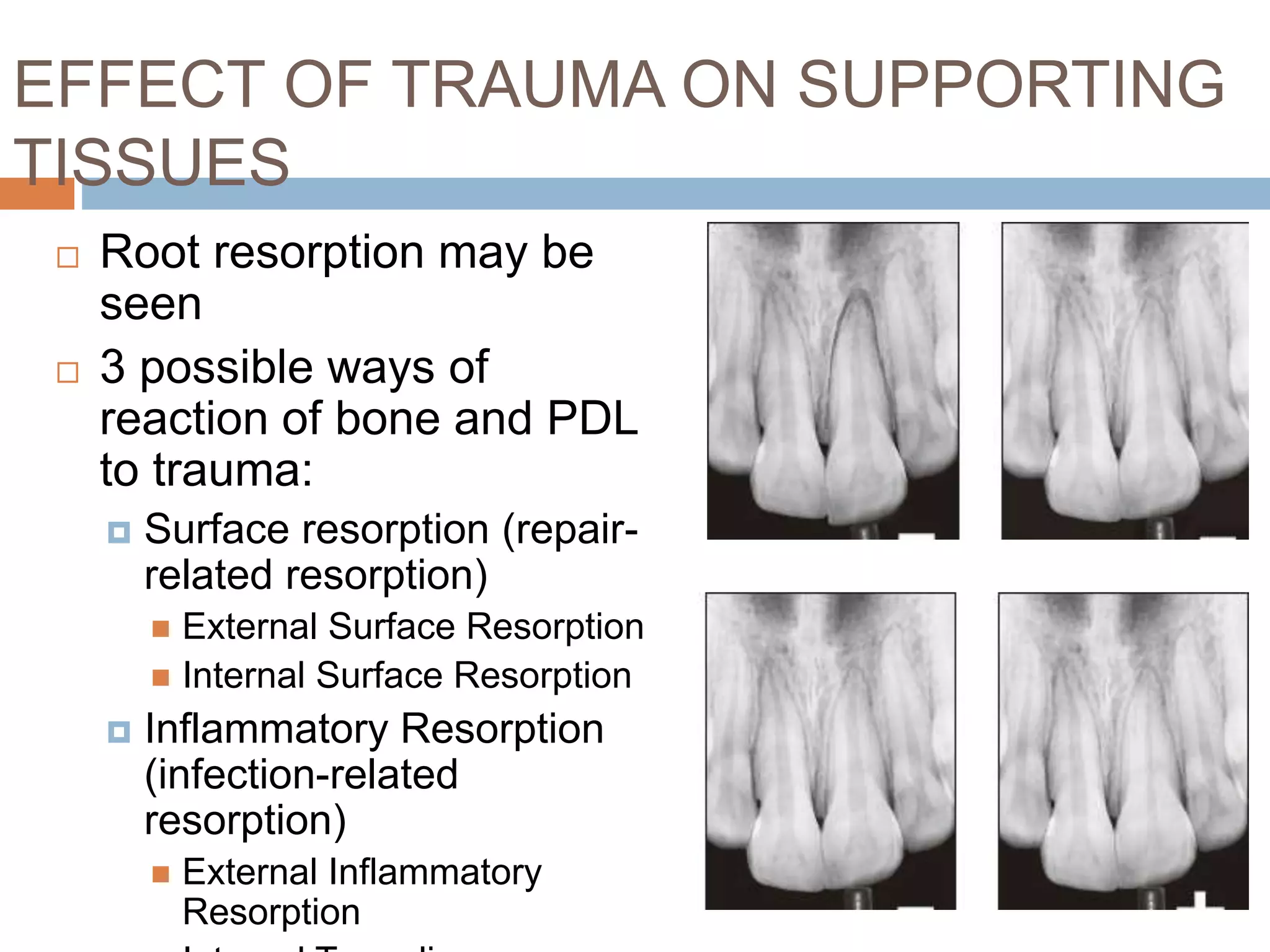 Treatment of Traumatized Teeth | PPTX