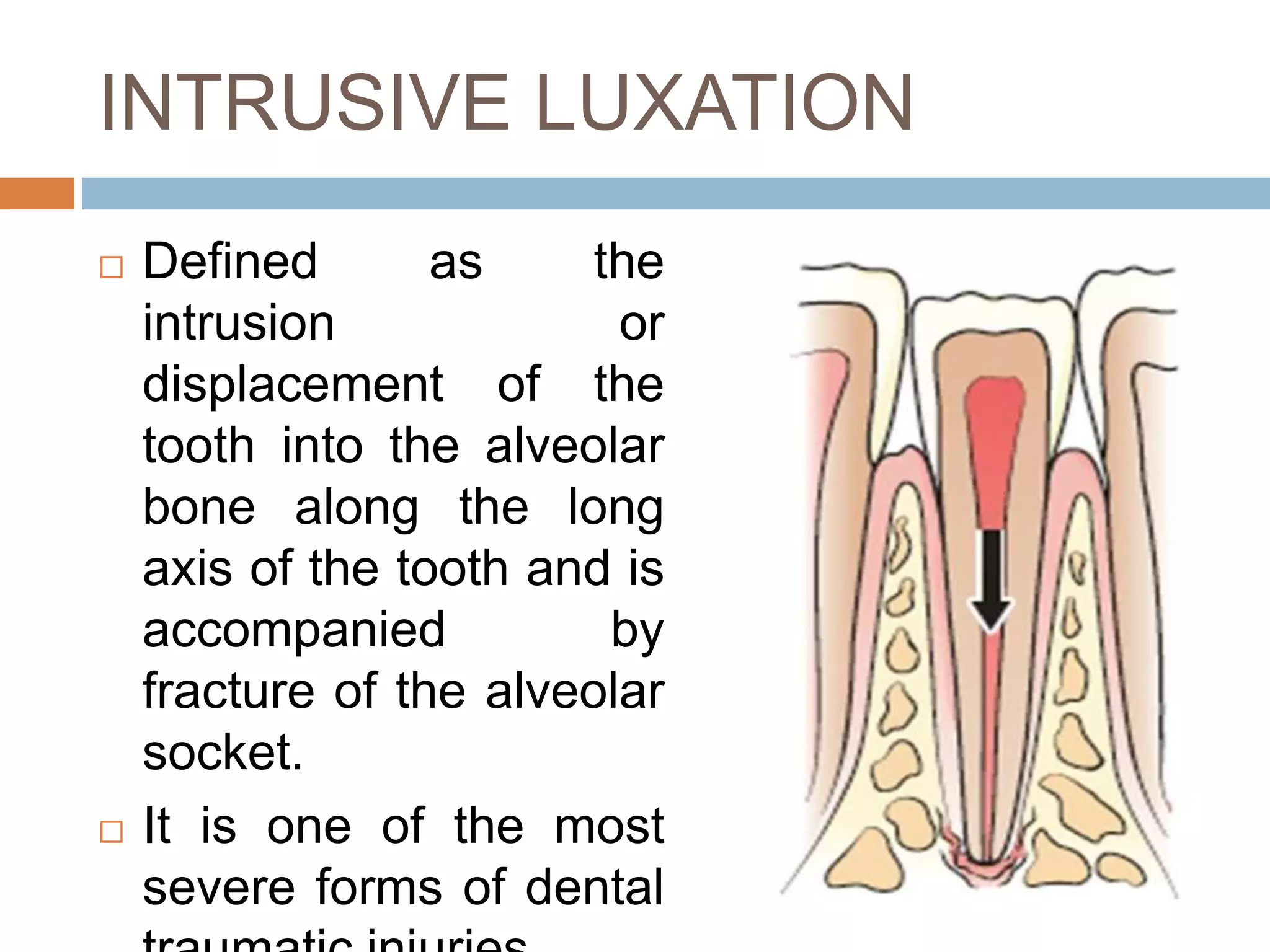 Treatment of Traumatized Teeth | PPTX