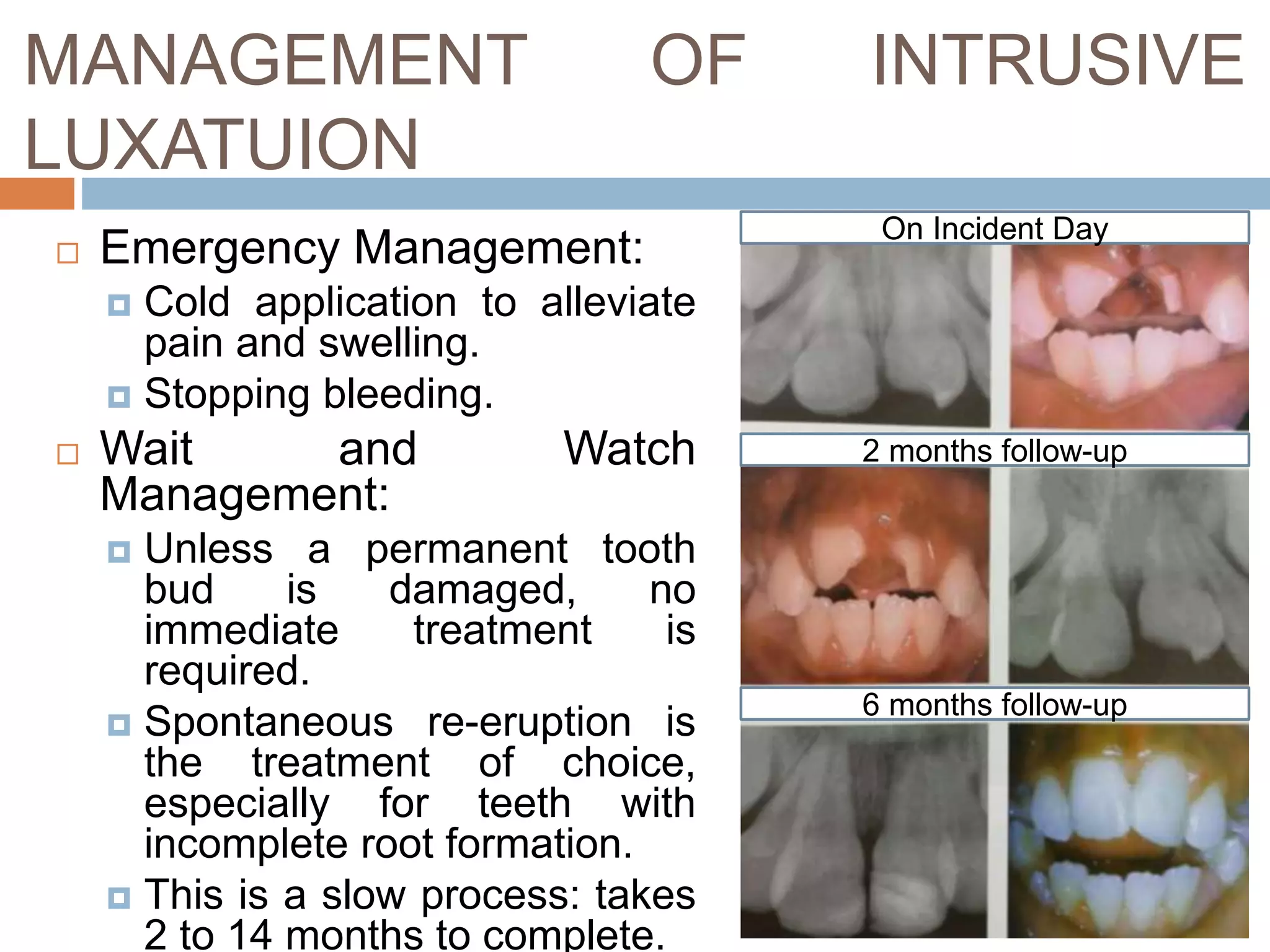 Treatment of Traumatized Teeth | PPTX