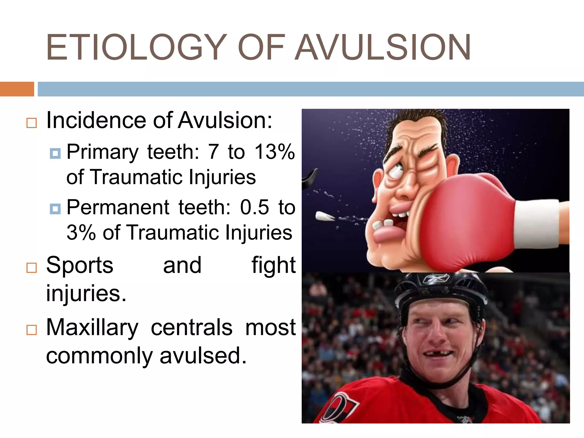 Treatment of Traumatized Teeth | PPTX