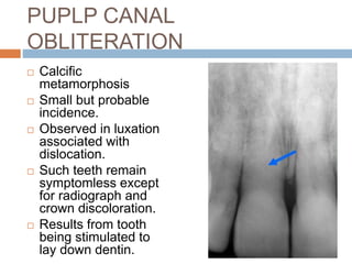 Treatment of Traumatized Teeth | PPTX