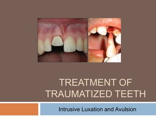Tooth Intrusion