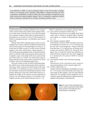 Treatment options for central retinal artery occlusion 2012 | PDF