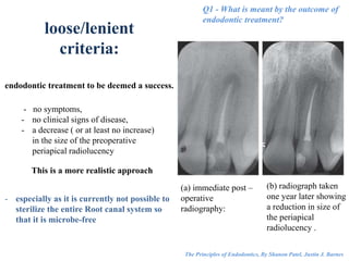 Endodontics Treatment outcome | PPTX