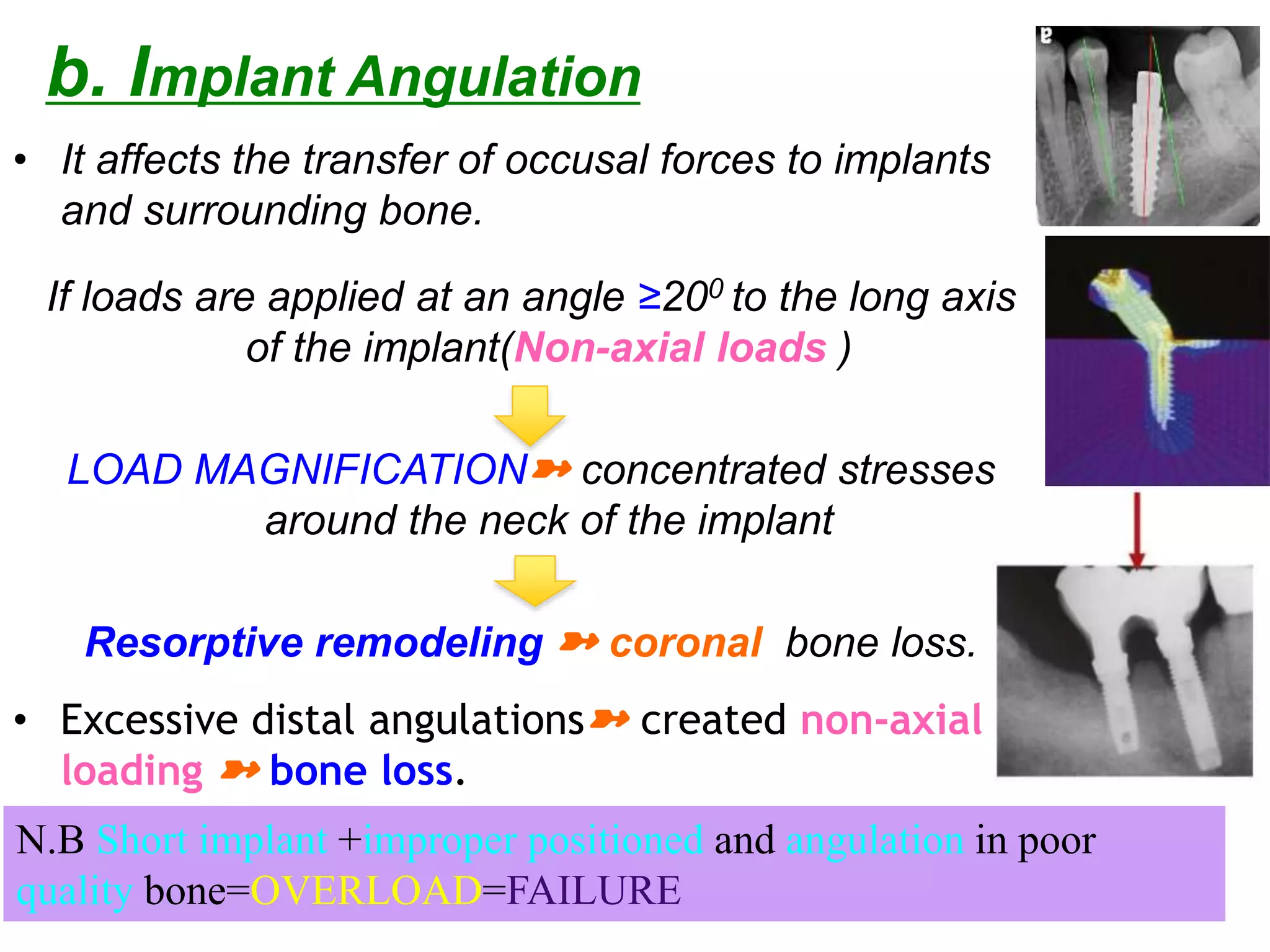 Treatment plan and biological consideration of implants | PPT