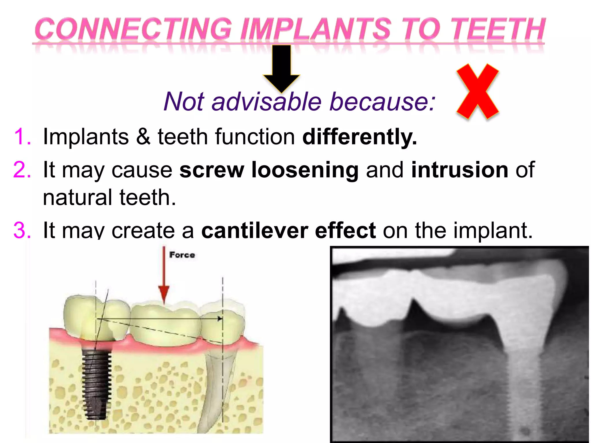 Treatment plan and biological consideration of implants | PPT