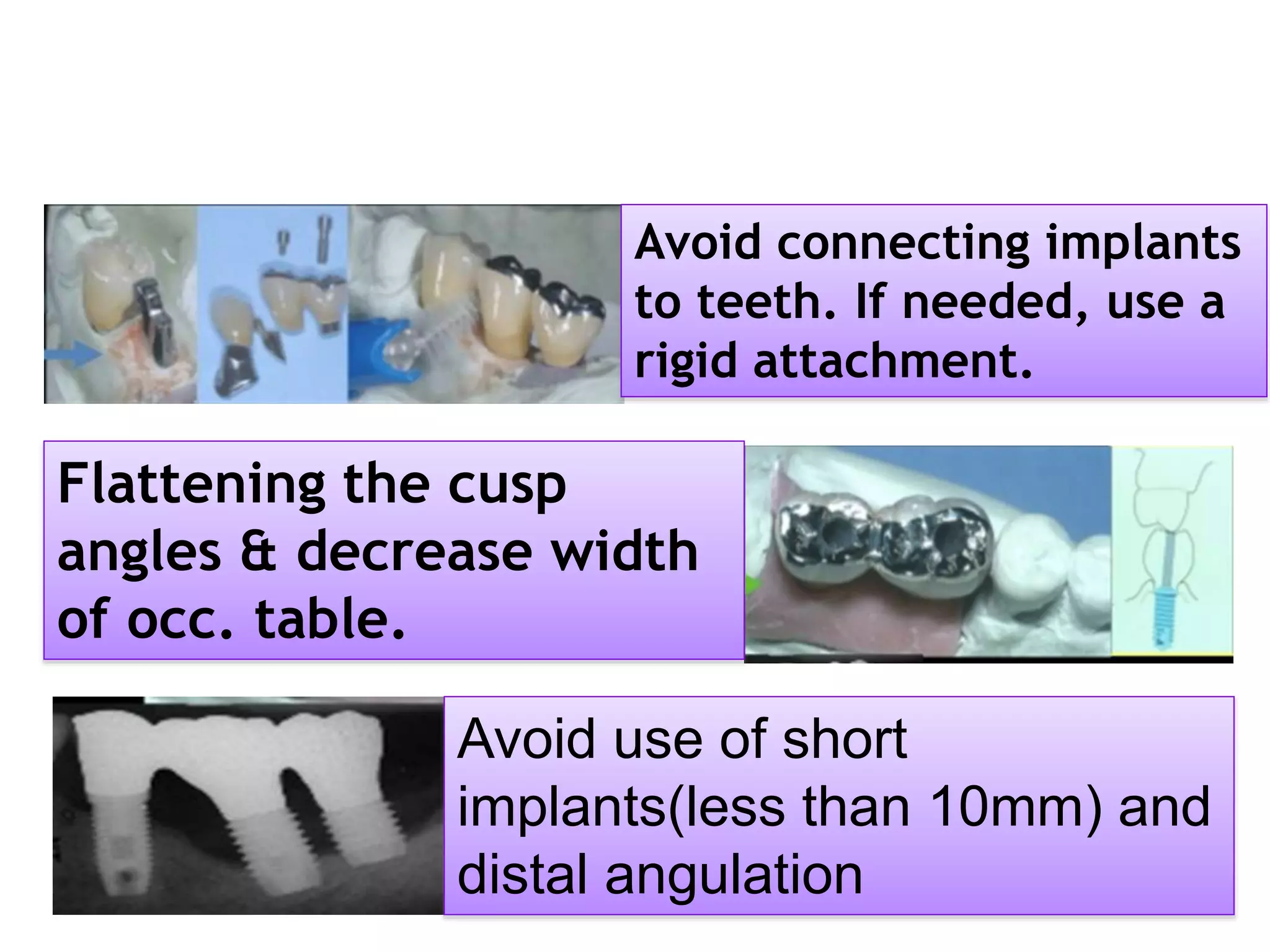 Treatment plan and biological consideration of implants | PPT