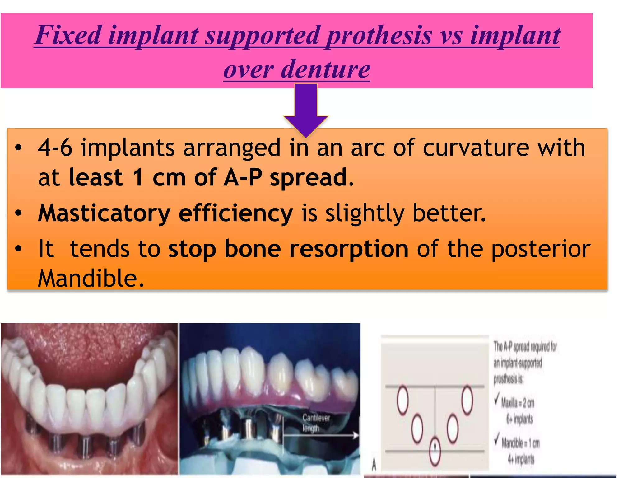 Treatment plan and biological consideration of implants | PPT